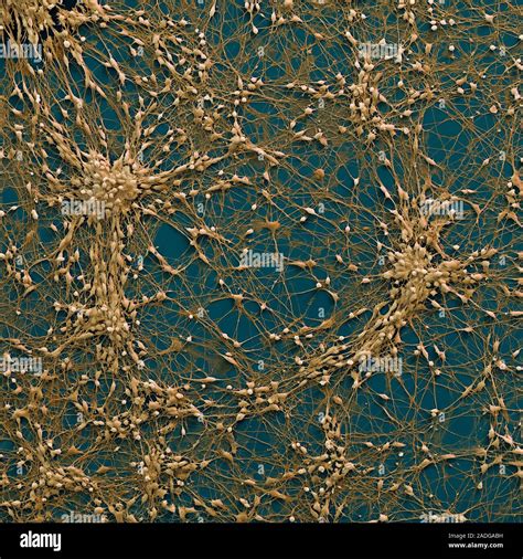 Human Neural Progenitor Cells In A Culture Medium Coloured Scanning Electron Micrograph Sem
