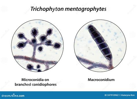 Fungi Trichophyton Mentagrophytes 3d Illustration Stock Illustration Illustration Of