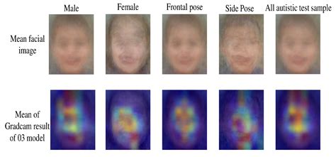 Efficient Deep Learning Based Data Centric Approach For Autism Spectrum