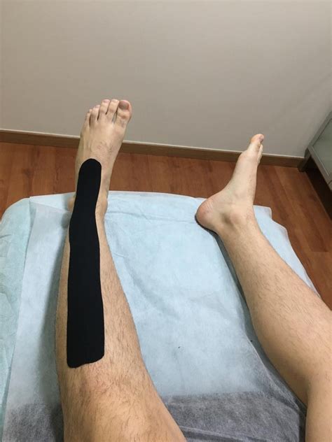 Periostitis Tibial Síntomas Tratamiento Y Ejercicios Recomendados