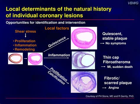 Ppt Myocardial Ischemia Redefined Optimal Care In Cad Powerpoint Presentation Id 363532