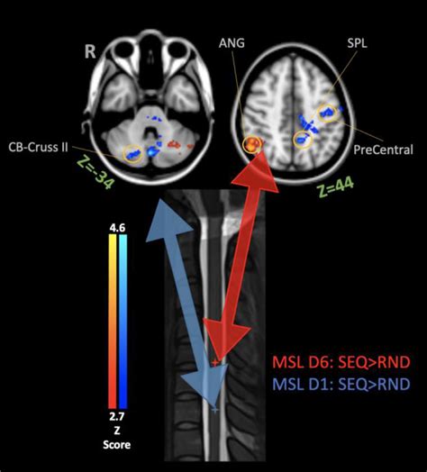 Activation Maps Showing Brain Regions For Which Their Functional Download Scientific Diagram