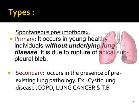 Pneumothorax 141221114833 Conversion Gate02pdf