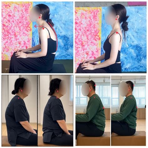 목 어깨통증이 심한데 어떻게 해야할까요 청주 재활필라테스 네이버 블로그