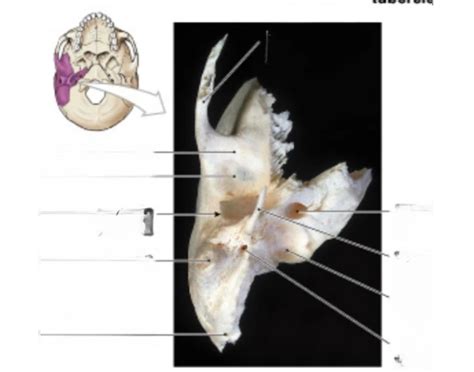 Temporal Bone Right Temporal Bone Inferior View — Printable Worksheet