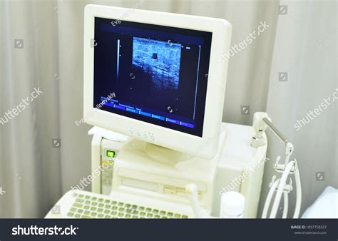 Diagnosis Varicose Veins Result Ultrasound Examination Stock Photo Shutterstock
