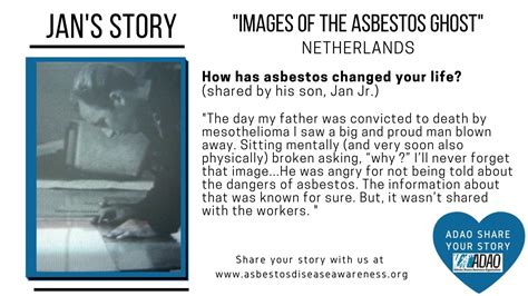 How To Test For Concussion Pupils