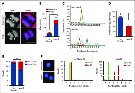 Chromosome Segregation Defects And Nonmodal Karyotypes In Hyperd All