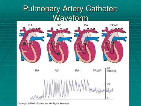 Ppt Hemodynamic Monitoring Powerpoint Presentation Id 4750943