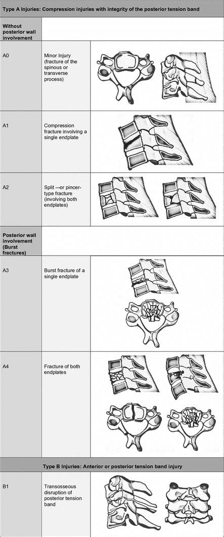 The Aospine Subaxial Cervical Spine Injury Classification Main