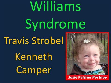 Williams Syndrome Life Expectancy