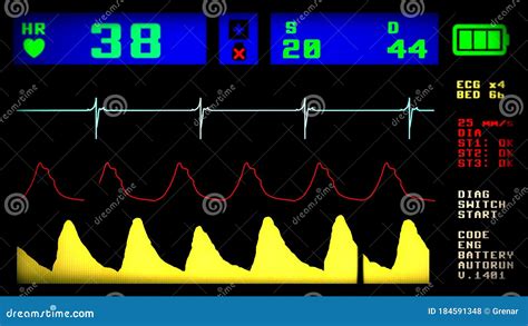 Ecg Screen Simulation Stock Illustration Illustration Of Check 184591348