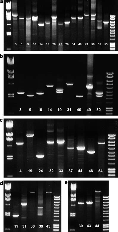 8 14 Long Pcr Products Depicted Are The Pcr Products Obtained With Download Scientific