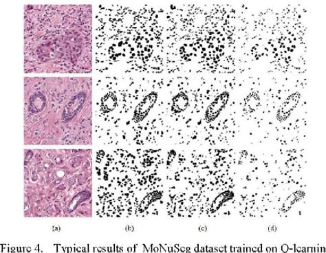 Figure 4 From Improving Nuclei Segmentation In Pathological Image Via Reinforcement Learning
