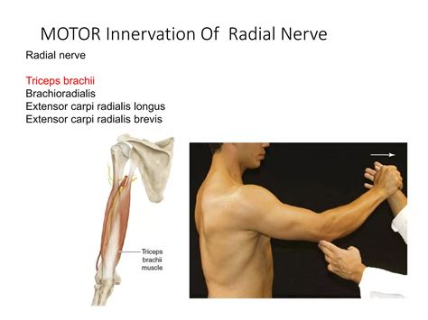 Radial Nerve Entrapment Pptx
