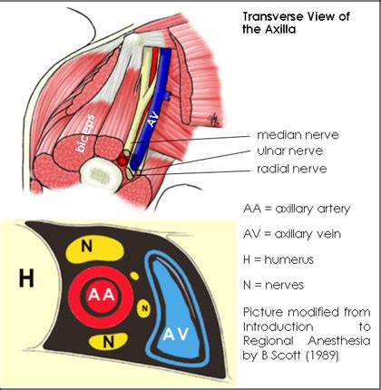 Axillary Nerve Block