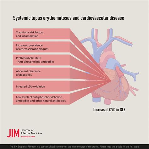 Systemic Lupus Erythematosus