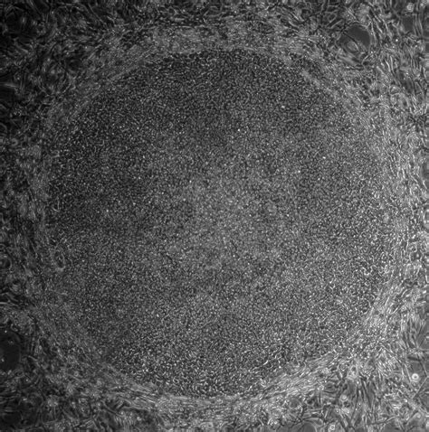 Ips Cells And Reprogramming Turn Any Cell Of The Body Into A Stem Cell