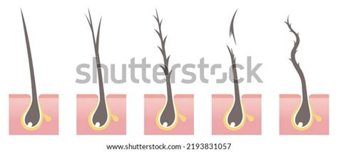Scalp Inside Over 41 Royalty Free Licensable Stock Illustrations Drawings Shutterstock