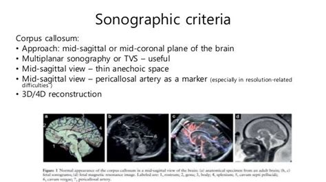 Fetal Brain Anomalies