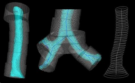 General Results Of The Region Growing Algorithm Used As The First Step Download Scientific