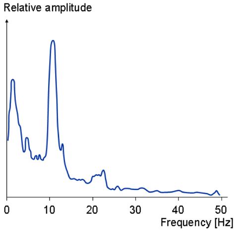 The Magnitude Spectrum Of A Normal Eeg Signal Download Scientific Diagram