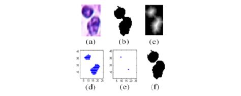 Cell Splitting On Touching Cells A Initial Image B Image After Download Scientific Diagram