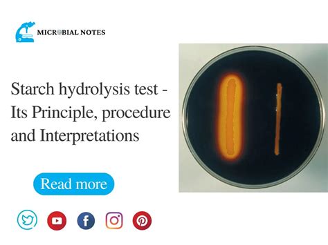 Starch Hydrolysis Test Its Principle Procedure And Results