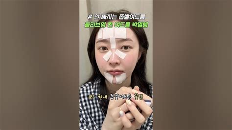 광고 6월 올영세일🔥 올리브영에서 이거 보이면 무조건 사세요 찐으로 효과본 여드름 뷰티꿀템 좁쌀여드름 올리브영추천템 올영세일 Youtube