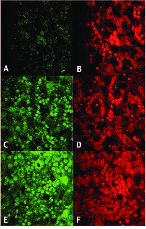 Increasing Accumulation Of β Catenin In The Nuclei Of Body Column Cells