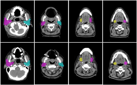 Figure 1 From Training Deep Learning Segmentation Models From Severely Limited Data Semantic