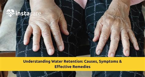 Water Retention Causes Symptoms Treatment And Prevention Tips
