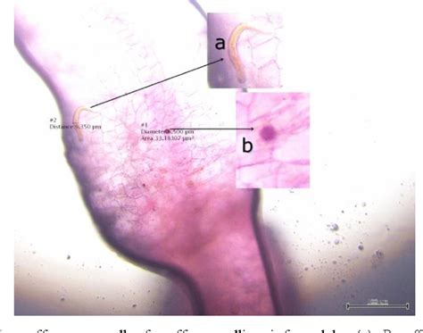Figure 2 From Role Of Mycorrhiza Helper Bacteria On Mycorrhizal