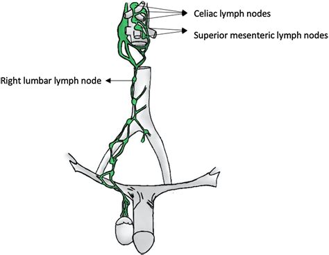 Magnetic Resonance Versus Computed Tomography For The Detection Of
