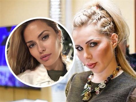 Боня До И После Пластики 64 Фотo