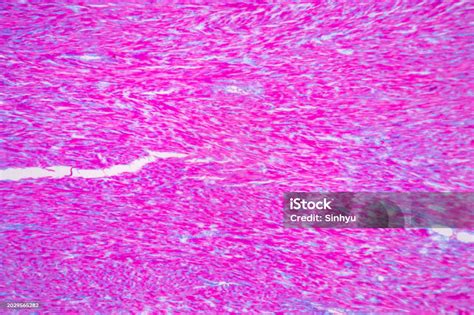 Anatomy And Histological Red Bone Marrow Human And Tendon Human Under The Microscope For