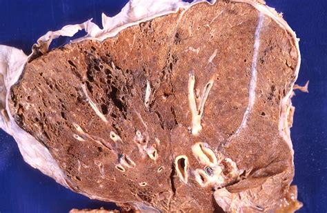 00015106 Peir Digital Library