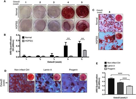 Osteoprogenitor Cells With Hgps Mutation Undergo Defective Osteogenic Download Scientific
