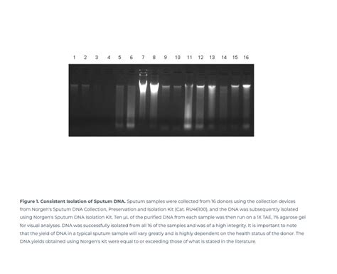 Norgen Biotek™ Sputum Dna Isolation Spin Column Kit Slurry Format 25 Preps
