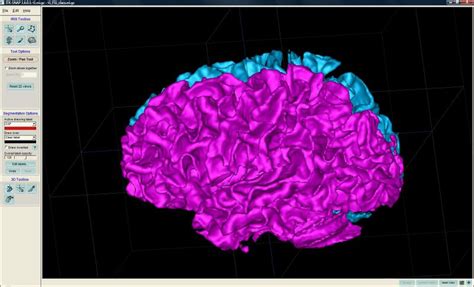 File 2  Psych 221 Image Systems Engineering