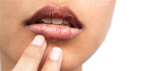 Peeling Or Chapped Lips Something You Eat Might Be To Blame Yourtango