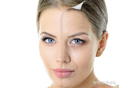 Fotona 4Dpro欧洲之星去黑眼圈和法令纹效果怎么样 知乎