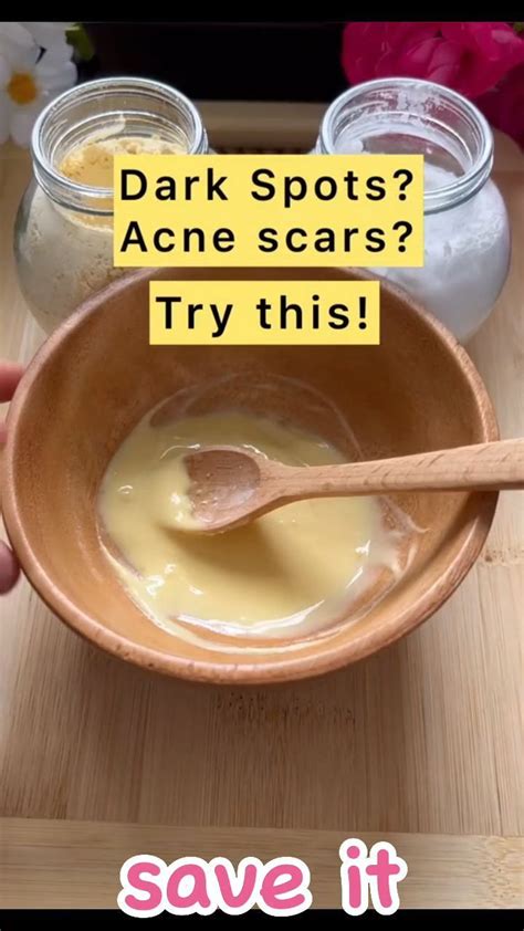 Dark Spots Acne Scars Try This Artofit