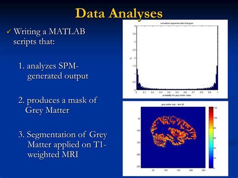 Ppt Volumetric Analysis Of Brain Structures Using Mr Imaging