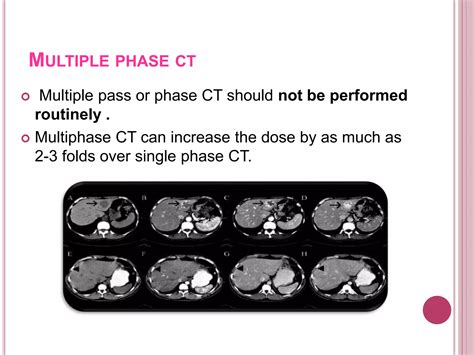 Ct Radiation Dose Reduction Pptx