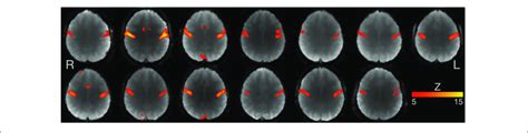Individual Fmri Results Based On Voxel Wise Multiple Linear Download Scientific Diagram