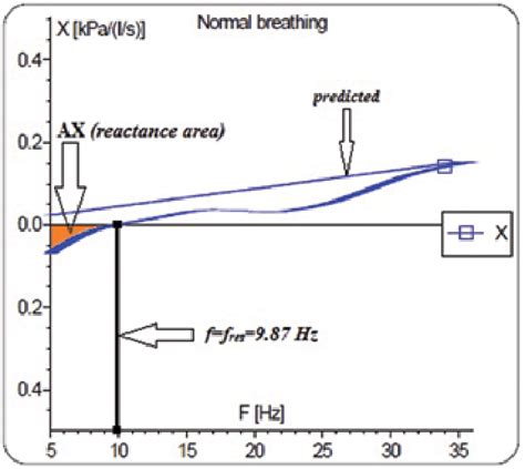 Impulse Oscillometry Ios Depiction Of The Reactance Xrs Frequency