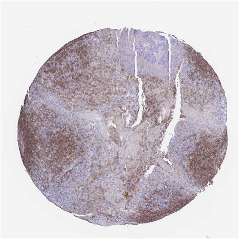 Tissue Expression Of Cd37 Staining In Tonsil The Human Protein Atlas