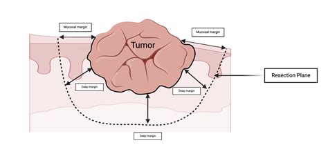 Data From Fluorescence Imaging Can Improve Outcomes In Head And Neck
