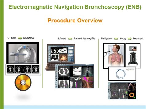 Electromagnetic Navigation Bronchoscopy Enb Clinical Review